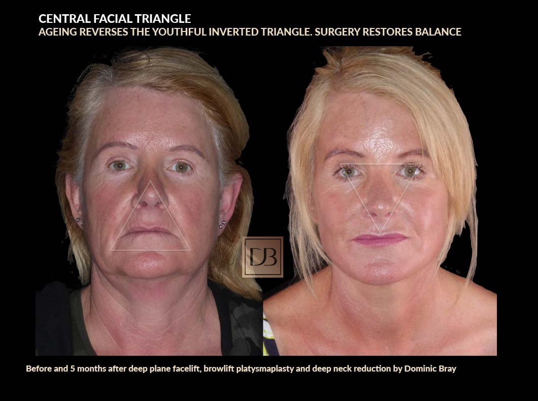 The Science of Beauty | Ogee Curve and Facial Shapes | Dr.Dominic Bray