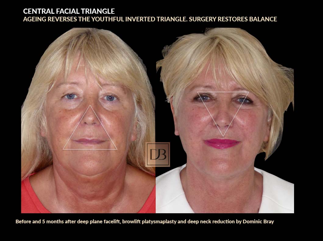 The Science of Beauty | Ogee Curve and Facial Shapes | Dr.Dominic Bray