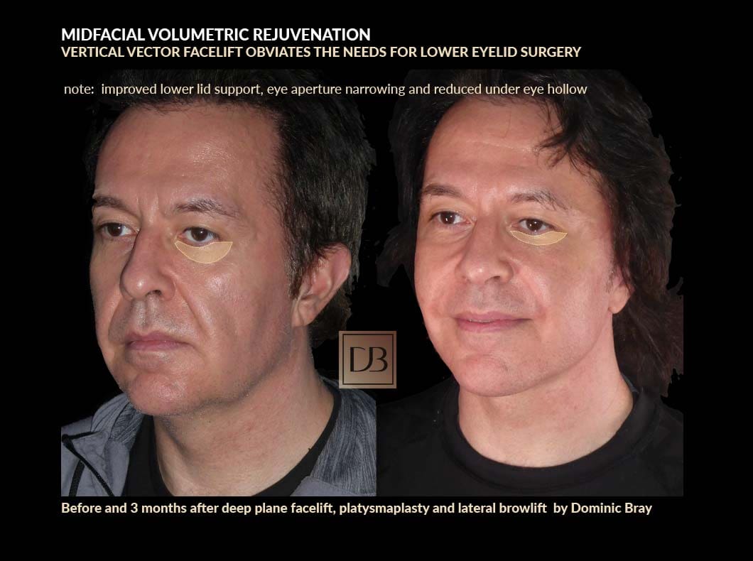 The Science of Beauty | Ogee Curve and Facial Shapes | Dr.Dominic Bray