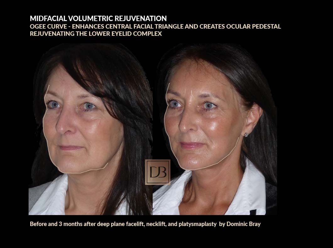 The Science of Beauty | Ogee Curve and Facial Shapes | Dr.Dominic Bray