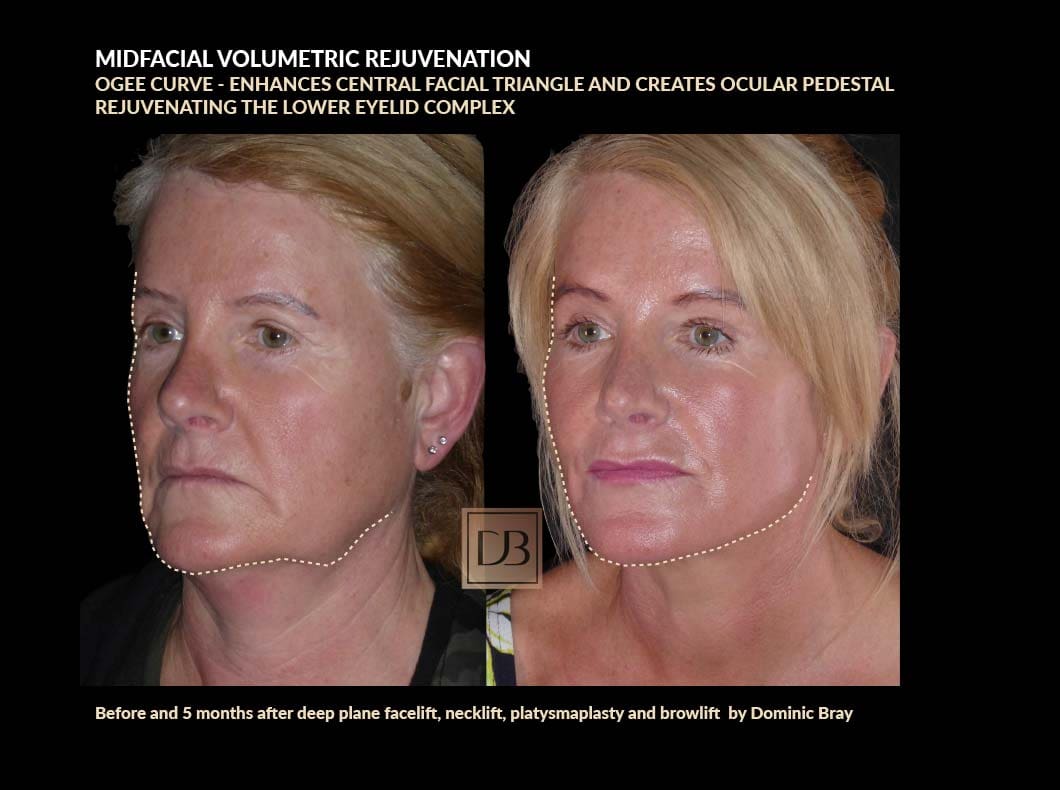 The Science of Beauty | Ogee Curve and Facial Shapes | Dr.Dominic Bray